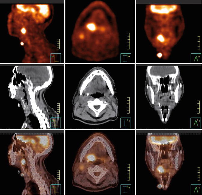 Nuclear Oncology | Radiology Key