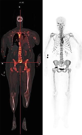 Musculoskeletal System | Radiology Key