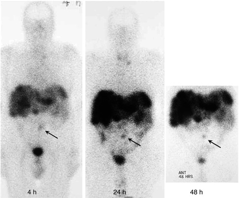 Endocrine System | Radiology Key