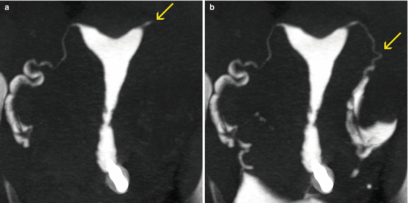 Normal Anatomy Radiology Human Body Anatomy Anatomy