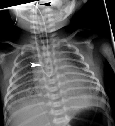 Chest Imaging | Radiology Key