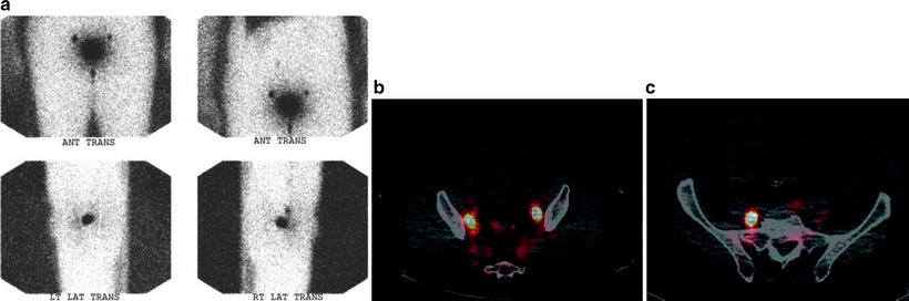 Gynecologic Cancers | Radiology Key