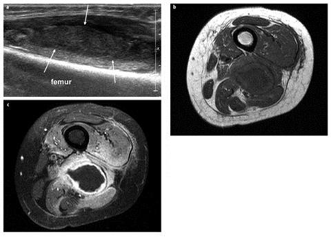 Musculoskeletal Abnormalities in Pediatrics | Radiology Key