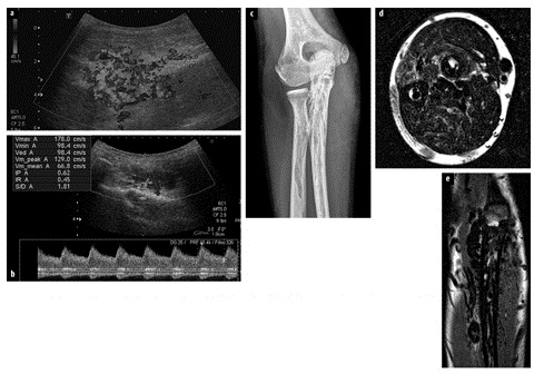 Malformations of the Musculoskeletal System | Radiology Key