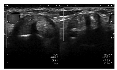 of the Hand and Wrist | Radiology Key