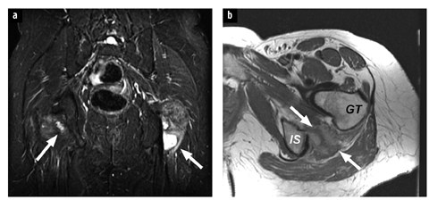 and Groin | Radiology Key