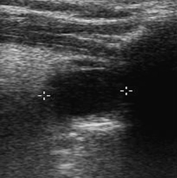 Neck Mass Radiology Key
