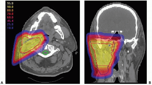 Head and Neck | Radiology Key
