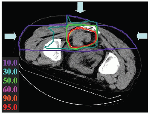 Gastrointestinal Malignancies Radiology Key