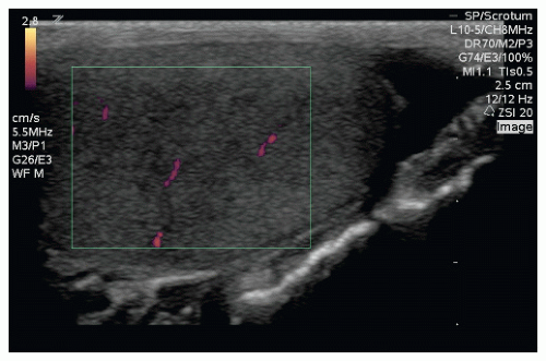 Fundamentals of Ultrasound | Radiology Key