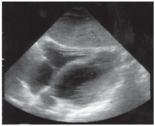 Trauma | Radiology Key