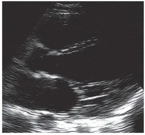 Echocardiography | Radiology Key