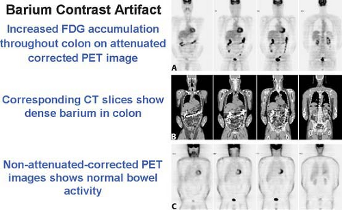 Fundamentals of CT in PET/CT | Radiology Key