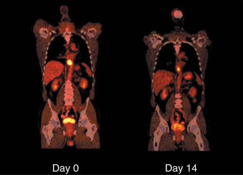 Esophagus | Radiology Key