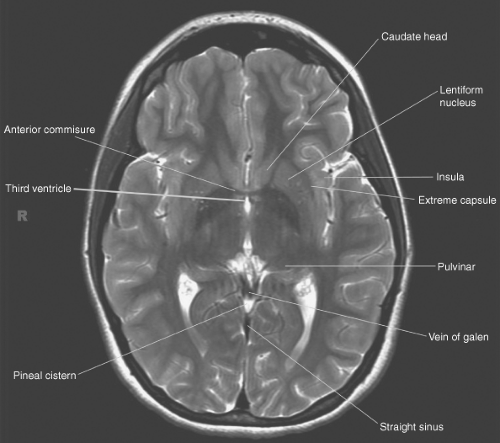 Introduction To Brain Imaging Radiology Key Free Nude Porn Photos Introduction To Brain Imaging Radiology Key Free Nude Porn Photos