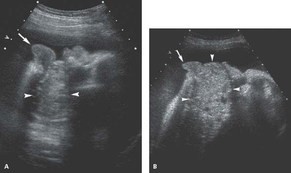 Face | Radiology Key