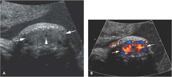 Neck | Radiology Key