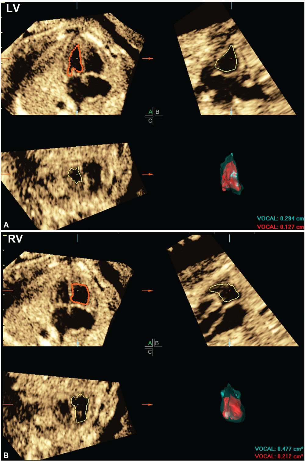 Three-Dimensional Ultrasonography | Radiology Key