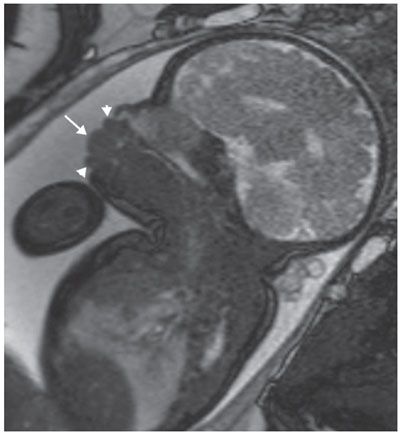 Neck | Radiology Key