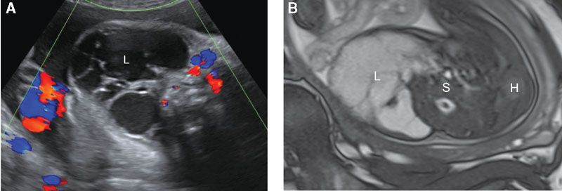 The Thorax | Radiology Key