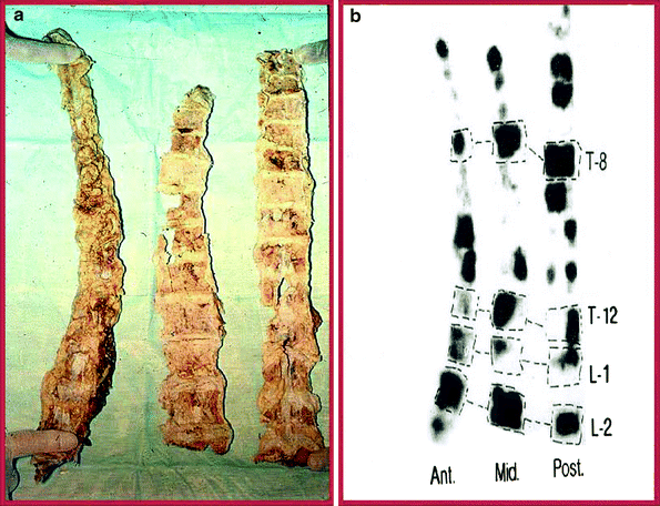 Radionuclides: Production, Physical Characteristics, and Applications ...