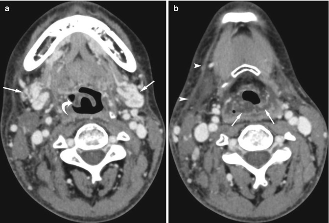 Head and Neck | Radiology Key