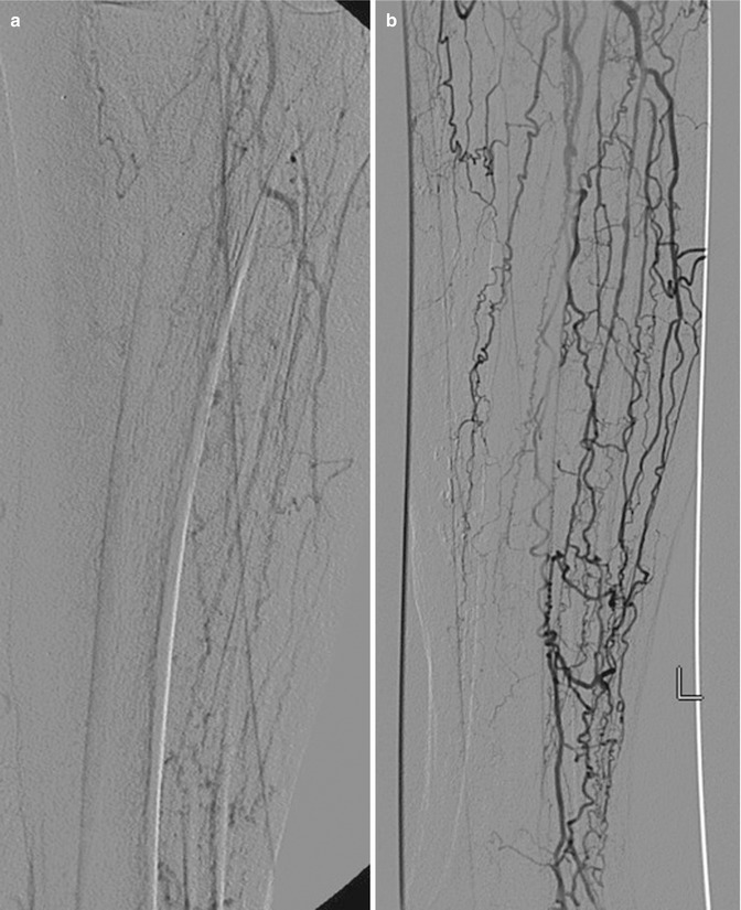 Vascular System | Radiology Key