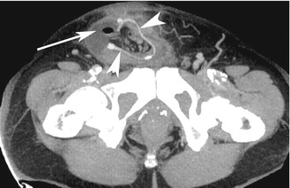 Genitourinary System | Radiology Key