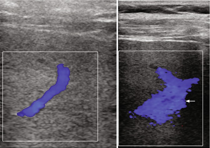 Ultrasound Imaging | Radiology Key