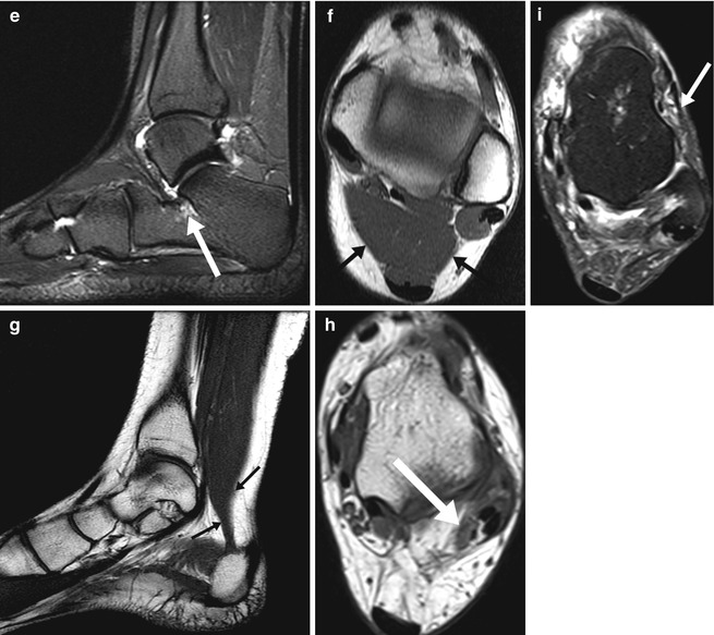 Musculoskeletal System | Radiology Key