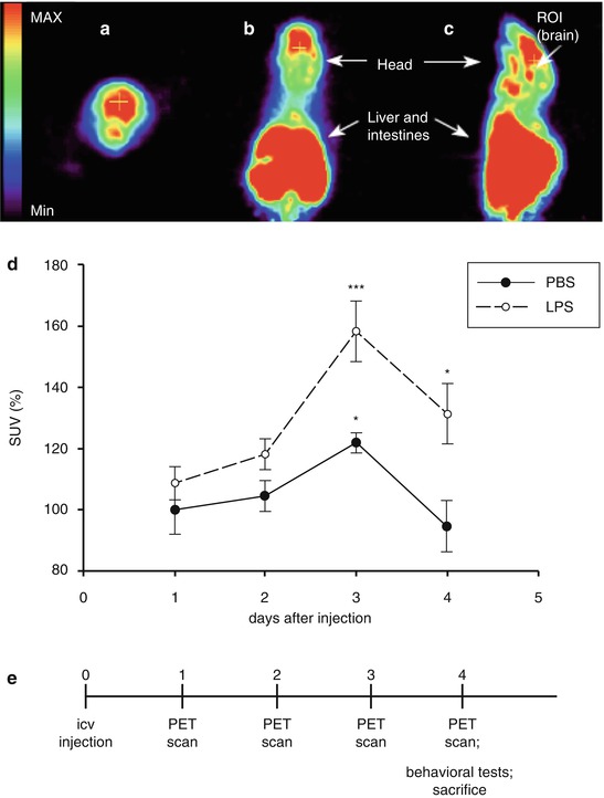 Linking Molecular Neurobiology to Therapeutic Approaches for Alzheimer ...