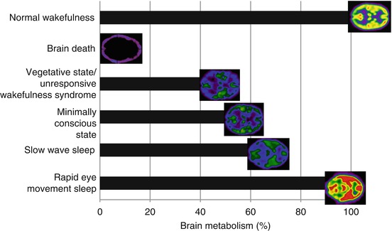 PET Imaging in Altered States of Consciousness: Coma, Sleep, and ...