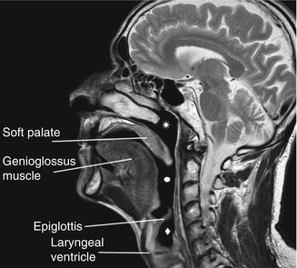 Head and Neck | Radiology Key