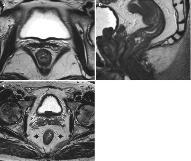 Gastrointestinal Tract Radiology Key