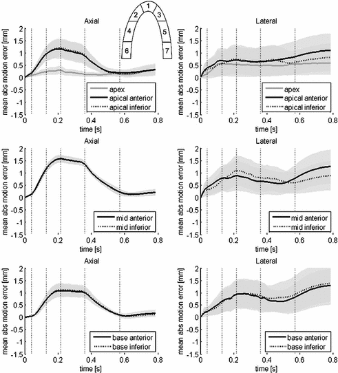 Motion Estimation Using Ultrafast Ultrasound Imaging Tested in a Finite ...