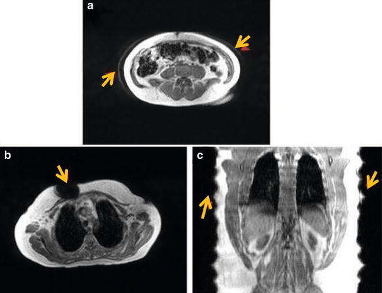 Data Acquisition and Corrections | Radiology Key