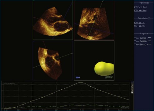 Volumetric Assessment | Radiology Key