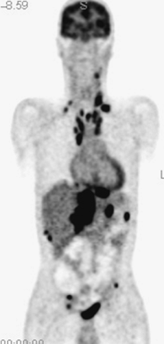 Endocrine Imaging | Radiology Key