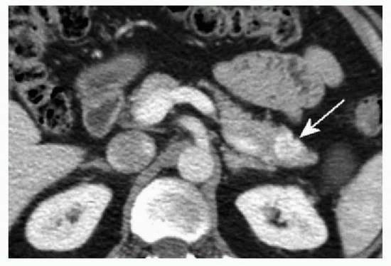 Endocrine System | Radiology Key