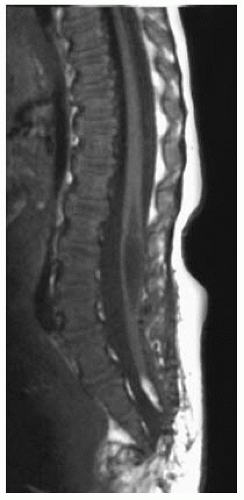 Congenital Malformations | Radiology Key