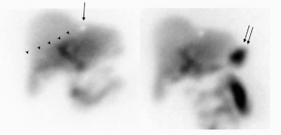 Gastrointestinal System | Radiology Key