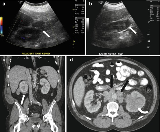 Kidneys | Radiology Key