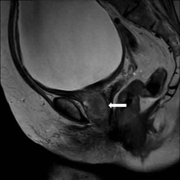Bladder and Urethra | Radiology Key