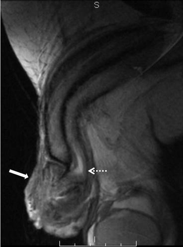 Male Pelvis | Radiology Key