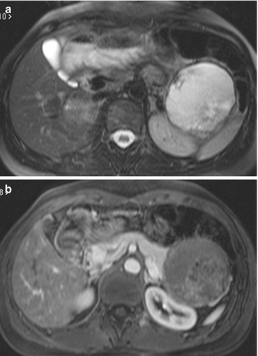 S | Radiology Key