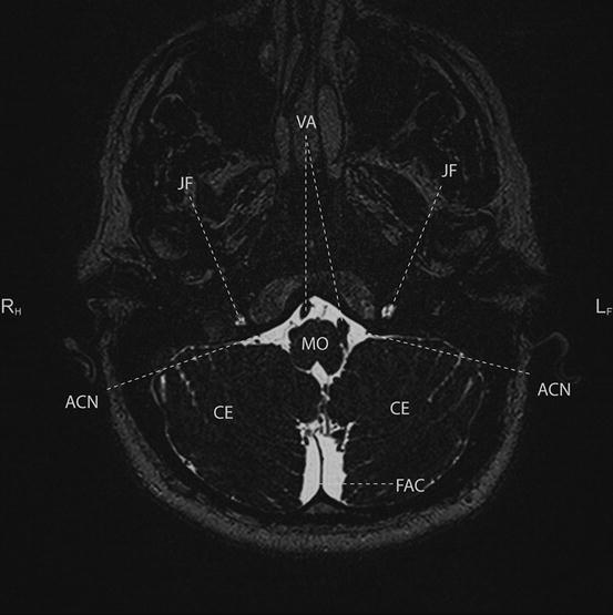 MRI Axial Sections | Radiology Key