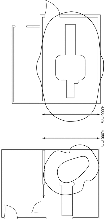 Site Planning | Radiology Key