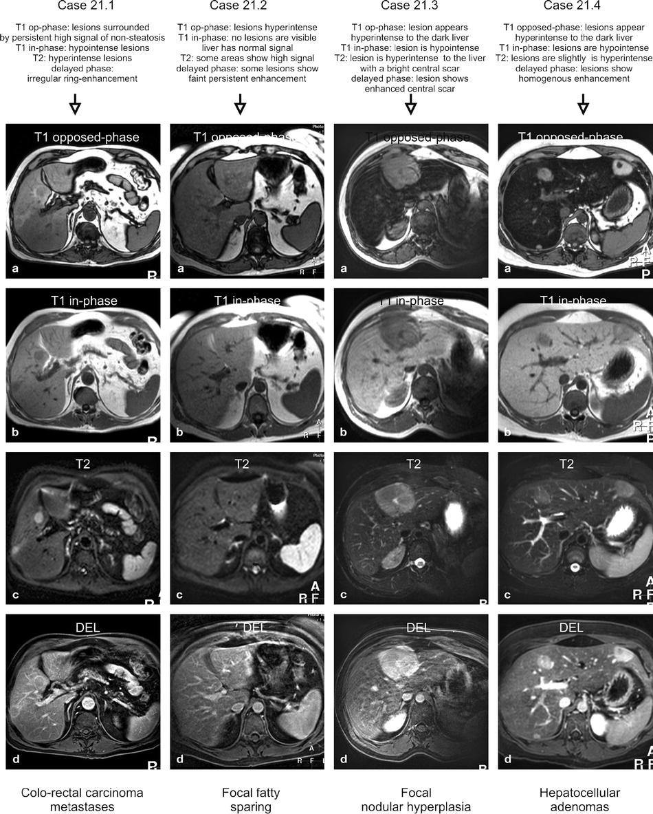Technique, Contrast, Safety, Anatomy, and Differential | Radiology Key