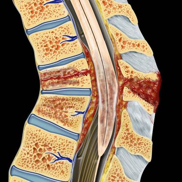 Fracture Classification | Radiology Key