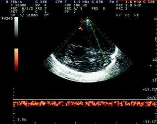 Ultrasound Anatomy and How to do the Examination | Radiology Key